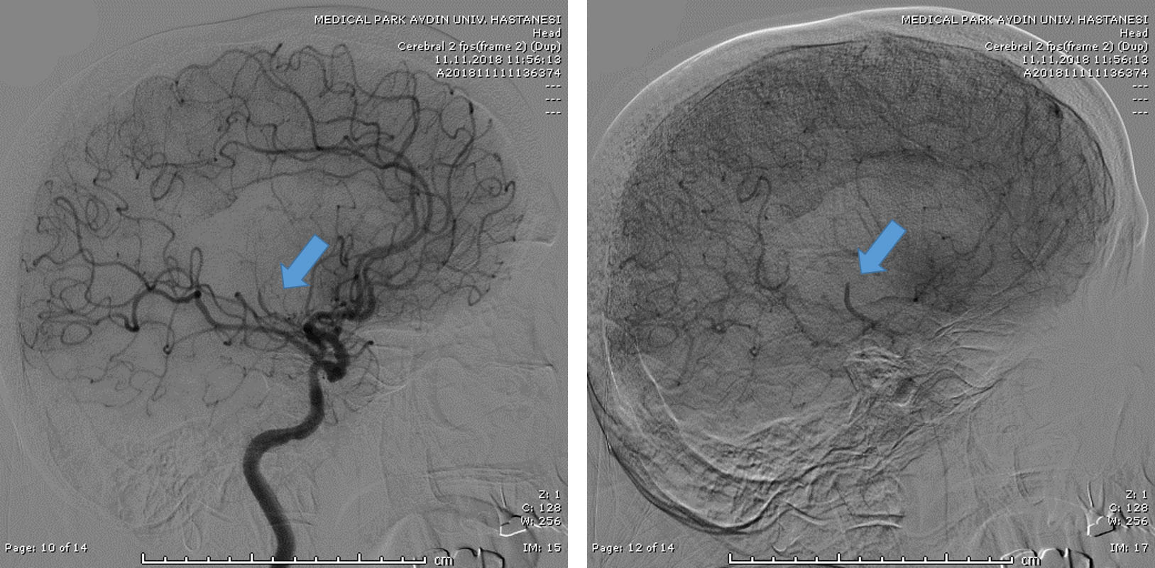 Medical Park NeVa Case 2 - Vesalio
