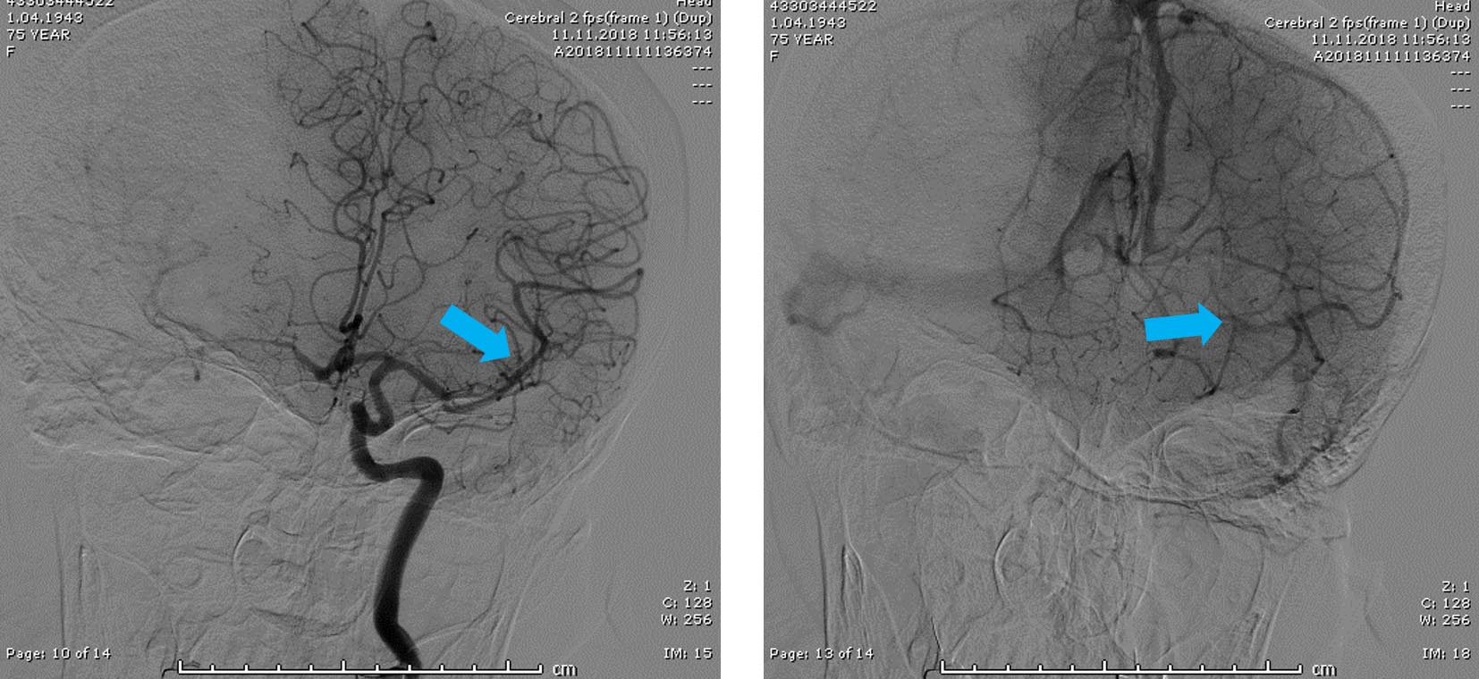 Medical Park NeVa Case 2 - Vesalio