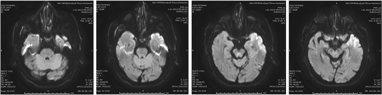 Medical Park NeVa Case 1 - Vesalio